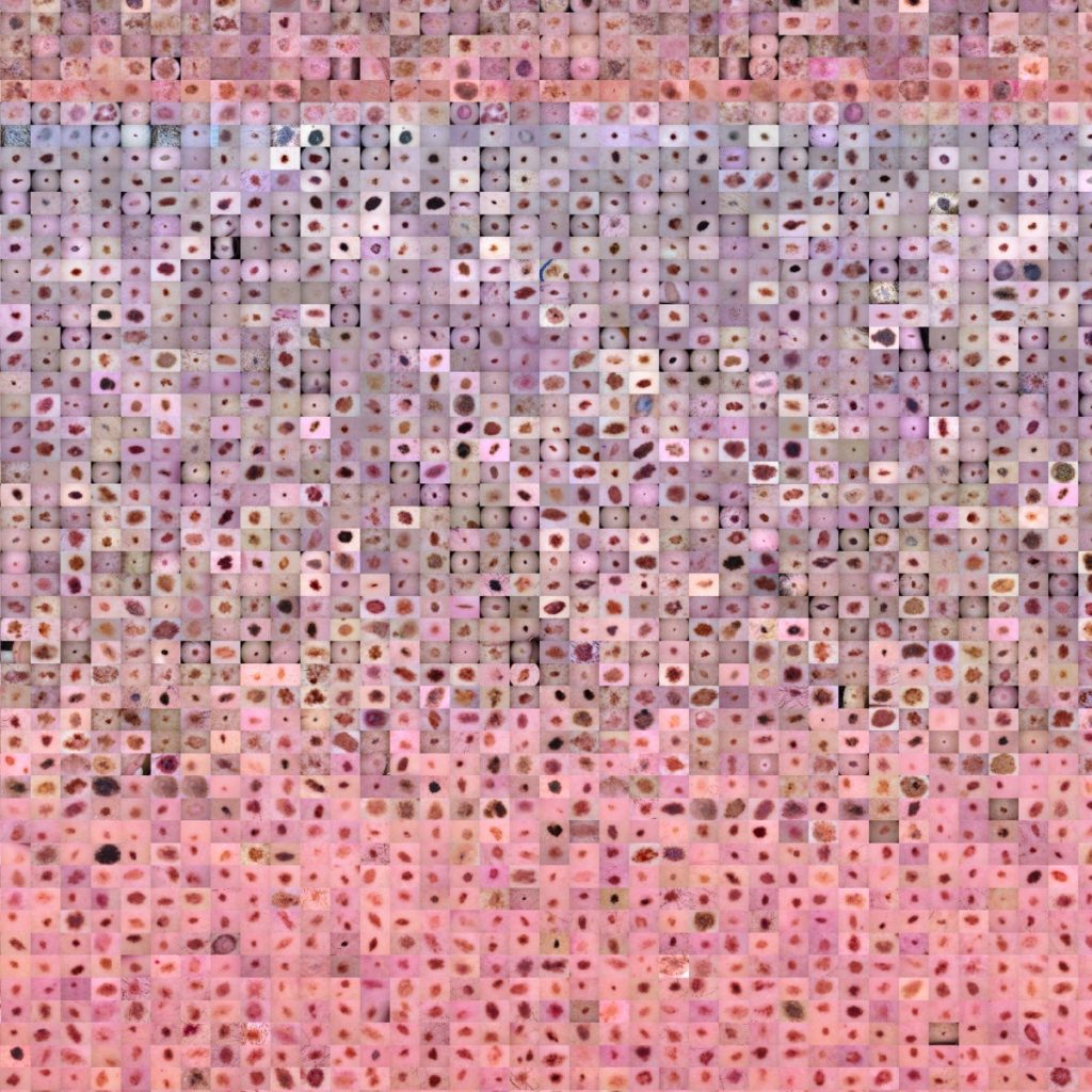 Deep Image Classification for Skin Cancer Detection